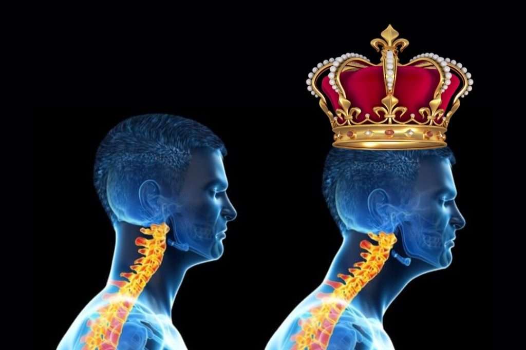 Forward Head Positioning & Wearing The Weight of The Crown → Synergy ...